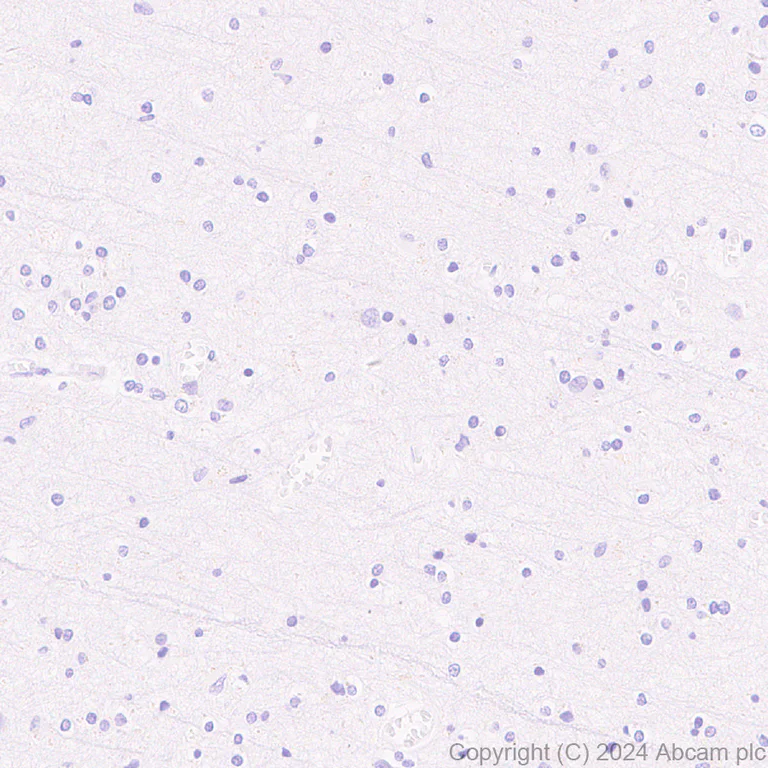 Anti-CXCL13 antibody [RM1170] - BSA and Azide free (ab317509) | Abcam