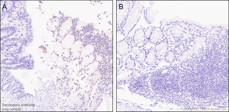 Anti-CXCL2 antibody [EPR28746-89] 20 ul size (ab317569) | Abcam