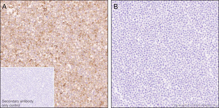 Anti-CXCL2 antibody [EPR28746-89] 20 ul size (ab317569) | Abcam