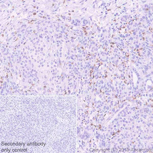 Anti-CXCR2 antibody [EPR22301-103] (ab225732) | Abcam