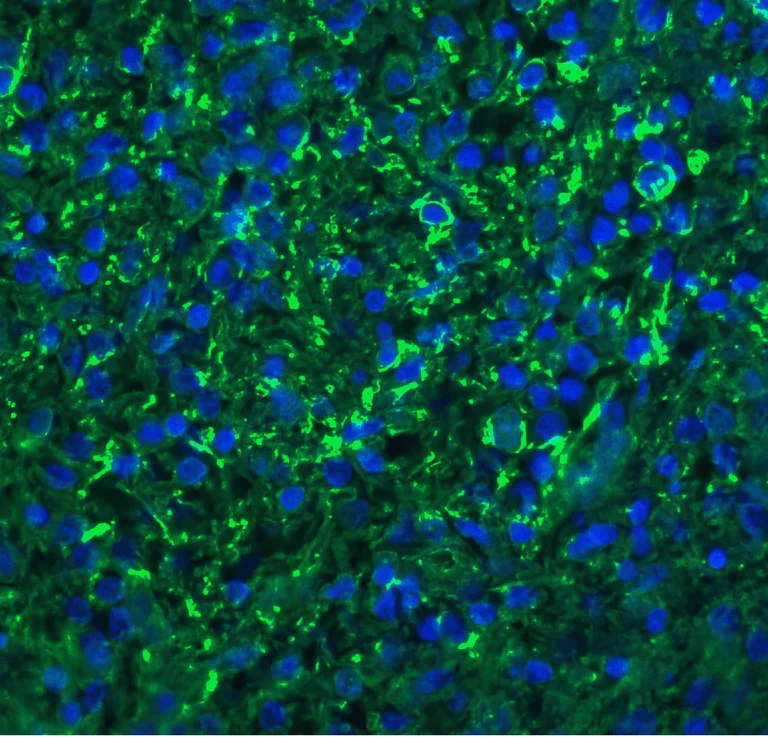 CXCR6抗体 (ab8023)| Abcam中文官网