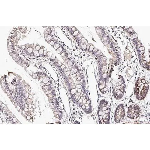 Anti-CXCR7 antibody [HL2189] (ab317157) | Abcam