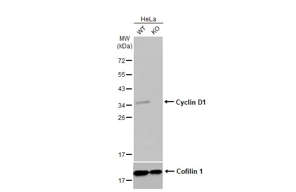 Anti-Cyclin D1 antibody [HL2219] (ab317167) | Abcam