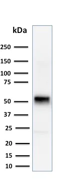 Cyclin E1抗体[CCNE1/2460] (ab238081)| Abcam中文官网