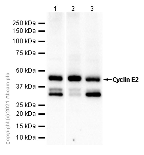 Anti-Cyclin E2 antibody [E142] (ab32103) | Abcam