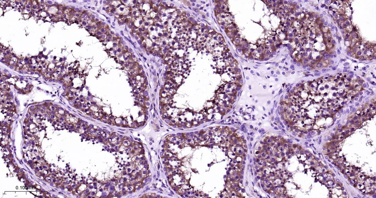 Anti-CYLD antibody [5C7] (ab326707) | Abcam中文官网