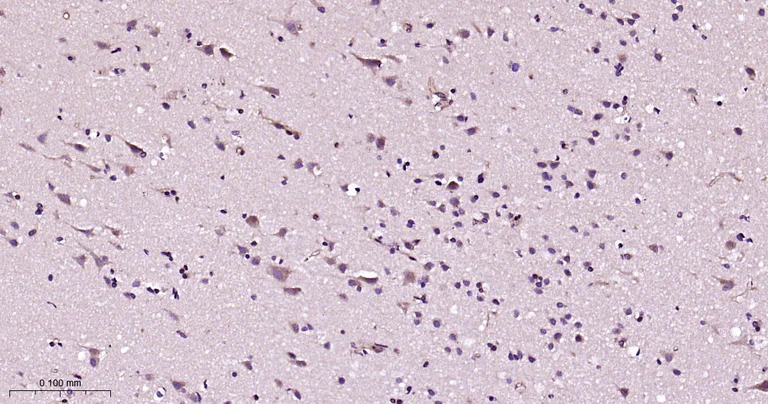 Anti-CYLD antibody [5C7] (ab326707) | Abcam中文官网