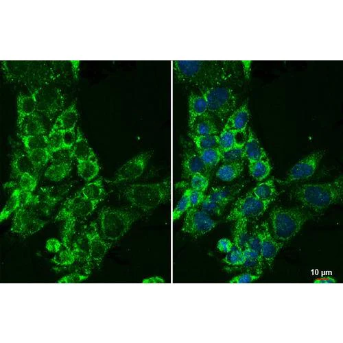 Anti-CYP27A1 antibody [HL1820] (ab317110) | Abcam中文官网