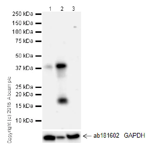 CYR61/CCN1抗体[EPR20681] (ab230947)| Abcam中文官网