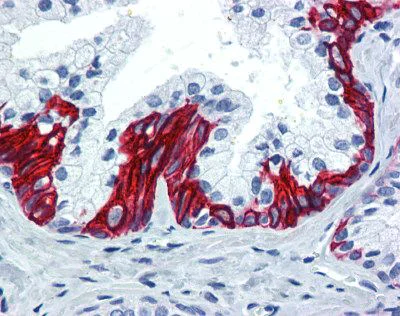 Anti-Cystatin SN/CST1 antibody (ab124281) | Abcam
