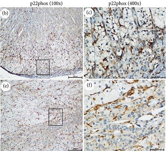 Anti-Cytochrome b245 Light Chain/p22-phox antibody (ab75941) | Abcam