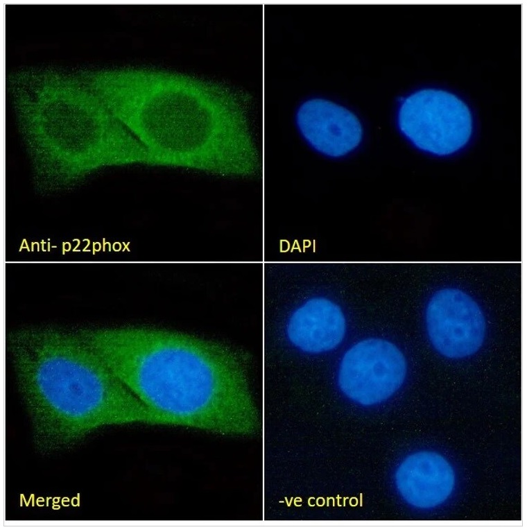 Anti-Cytochrome b245 Light Chain/p22-phox Antibody [CS9] (ab316356) | Abcam