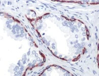 Cytokeratin 14抗体[SP53] (ab119695)| Abcam中文官网
