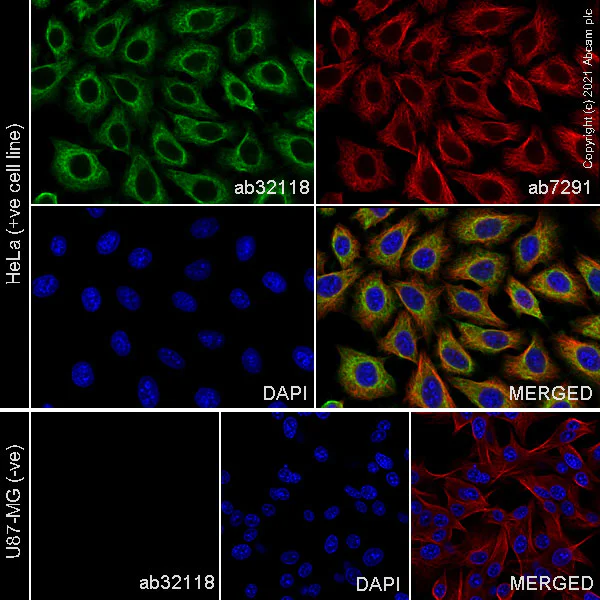 Cytokeratin 18抗体[E431-1] (ab32118)| Abcam中文官网