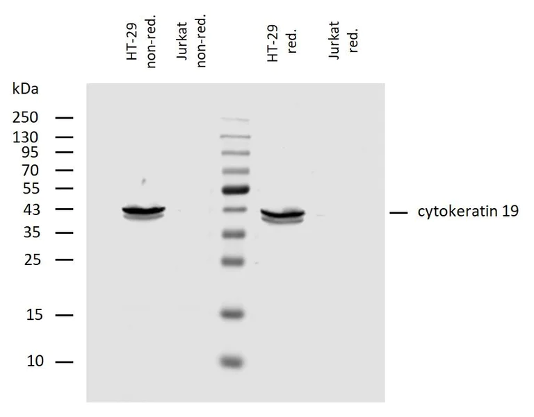 Anti-Cytokeratin 19 antibody [A53-B/A2] - Cytoskeleton Marker (ab7754) | Abcam