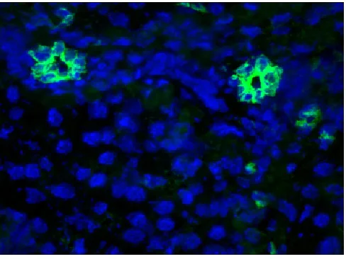 Anti-Cytokeratin 7 antibody [RCK105] - Cytoskeleton Marker (ab9021) | Abcam