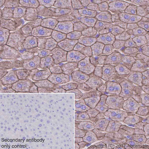 Anti-cytokeratin 8 antibody [EP1628Y] - cytoskeleton marker (ab53280) | Abcam