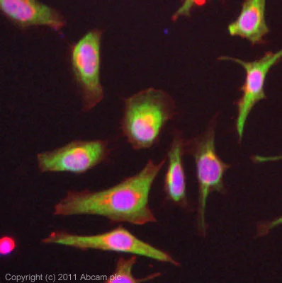 Anti-Cytokeratin antibody [MNF116] (ab756) | Abcam