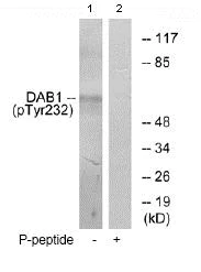 Dab1(磷酸化Y232)抗体 (ab78200)| Abcam中文官网
