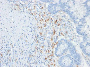 Anti-DC-SIGN antibody [C209/1781] (ab218419) | Abcam