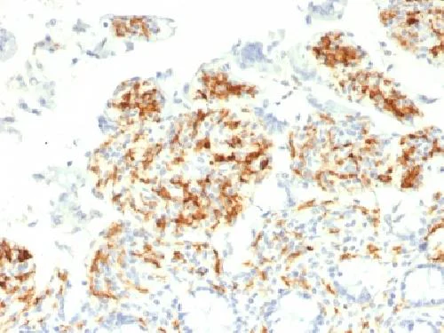 Anti-DC-SIGN antibody [C209/1781] - Carrier free (ab218883) | Abcam