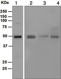 Anti-DC-SIGN antibody [EPR5588] (ab124828) | Abcam