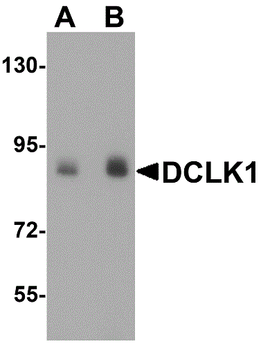 Anti-DCAMKL1 antibody (ab106635) | Abcam