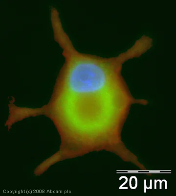 DCAMKL1抗体 (ab31704)| Abcam中文官网