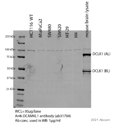 Anti-DCAMKL1 antibody - KO validated (ab31704) | Abcam