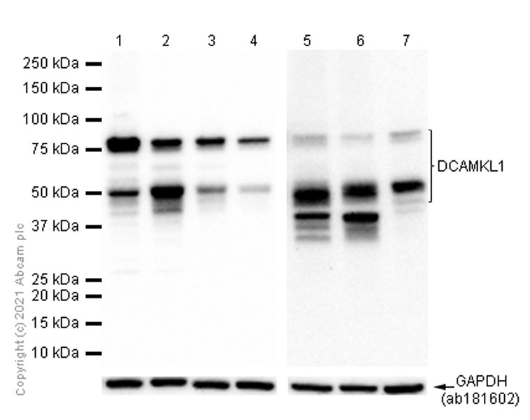 Anti-DCAMKL1 antibody [EPR6085] (ab109029) | Abcam