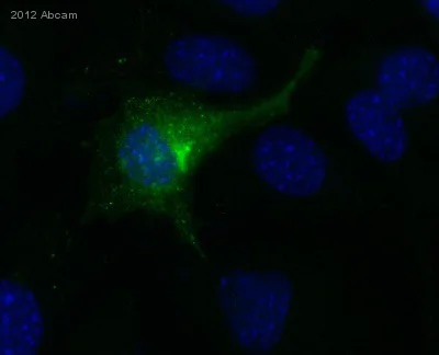 Anti-DDDDK tag (binds to FLAG® tag sequence) antibody (ab1162) | Abcam