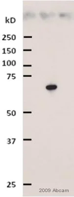 Anti-DDDDK tag (Binds to FLAG® tag sequence) antibody (ab1170) | Abcam