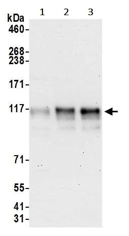 Anti-DDHD1 antibody (ab241975) | Abcam