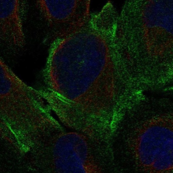 Anti-DDR2 antibody (ab221812) | Abcam