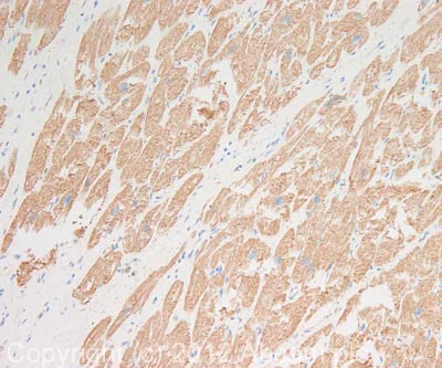 Anti-DDR2 antibody. Rabbit polyclonal (ab76967) | Abcam