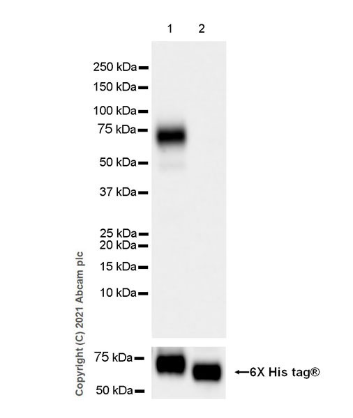 Anti-DDR2 antibody [EPR18826-119] (ab280354) | Abcam