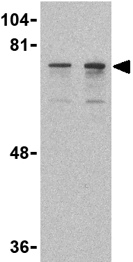 Anti-DDX3 antibody (ab37160) | Abcam