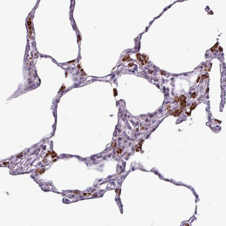 Anti-DEGA antibody (ab272658) | Abcam