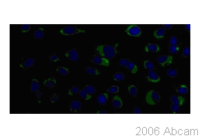 Anti-Dengue Virus prM glycoprotein antibody [DM1] (ab41473) | Abcam