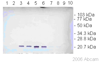 Anti-Dengue Virus prM glycoprotein antibody [DM1] (ab41473) | Abcam