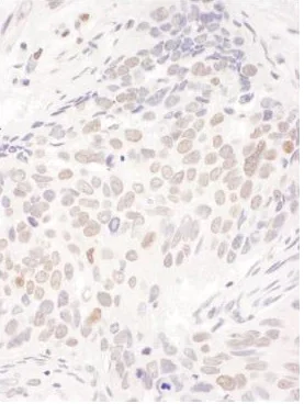 Anti-DENTT antibody (ab240596) | Abcam
