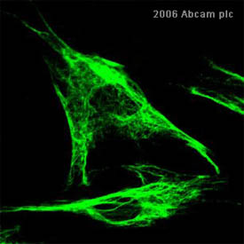 Anti-Desmin antibody, cytoskeleton marker (ab15200) | Abcam