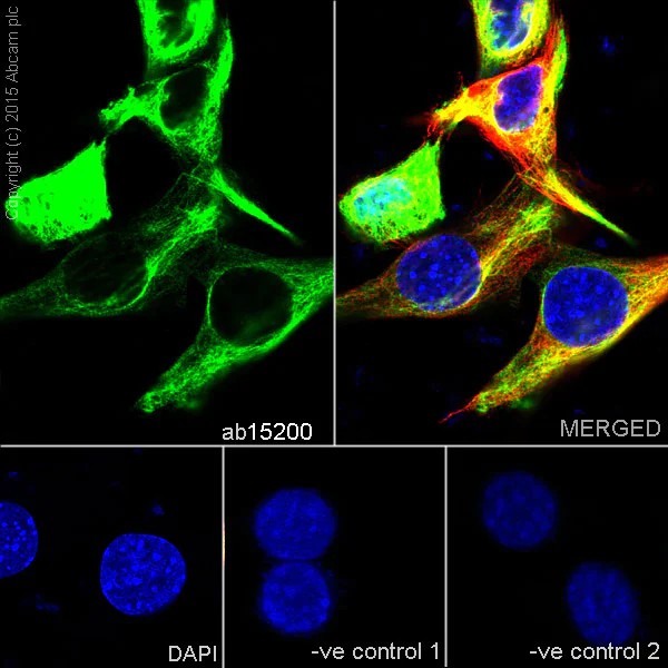 Desmin抗体- Cytoskeleton Marker (ab15200)| Abcam中文官网