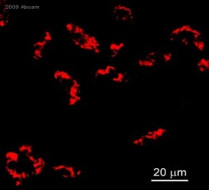 Anti-Desmin antibody, cytoskeleton marker (ab15200) | Abcam