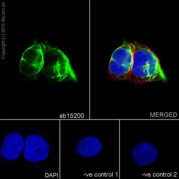 Anti-Desmin antibody, cytoskeleton marker (ab15200) | Abcam