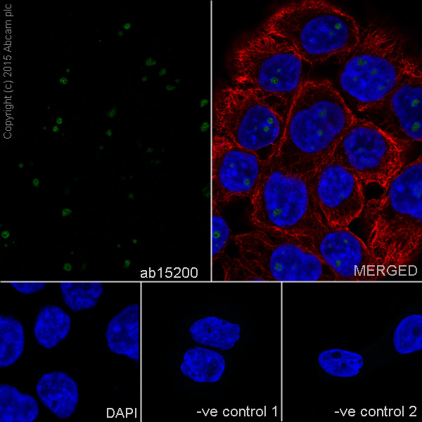 Anti-Desmin antibody, cytoskeleton marker (ab15200) | Abcam