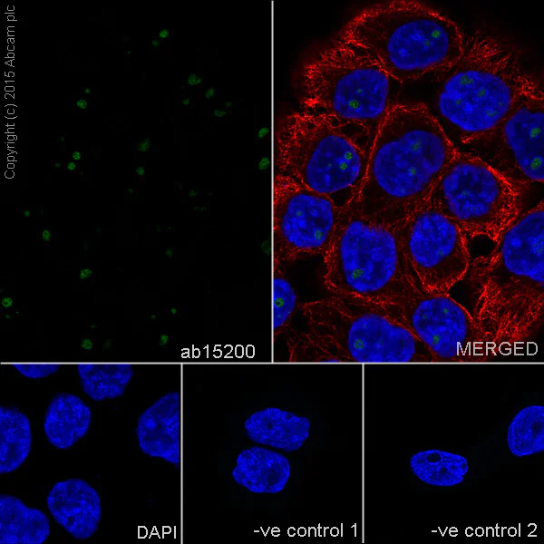 Desmin抗体- Cytoskeleton Marker (ab15200)| Abcam中文官网