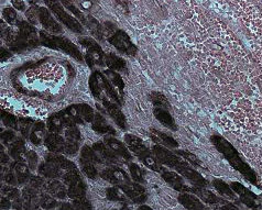 Desmin抗体- Cytoskeleton Marker (ab15200)| Abcam中文官网