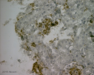 Anti-Desmin antibody, cytoskeleton marker (ab15200) | Abcam