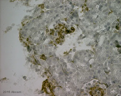 Desmin抗体- Cytoskeleton Marker (ab15200)| Abcam中文官网